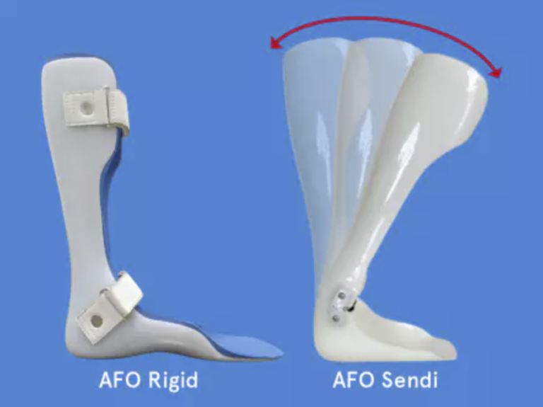 Ankle Foot Orthosis - Spine Clinic Family Holistic