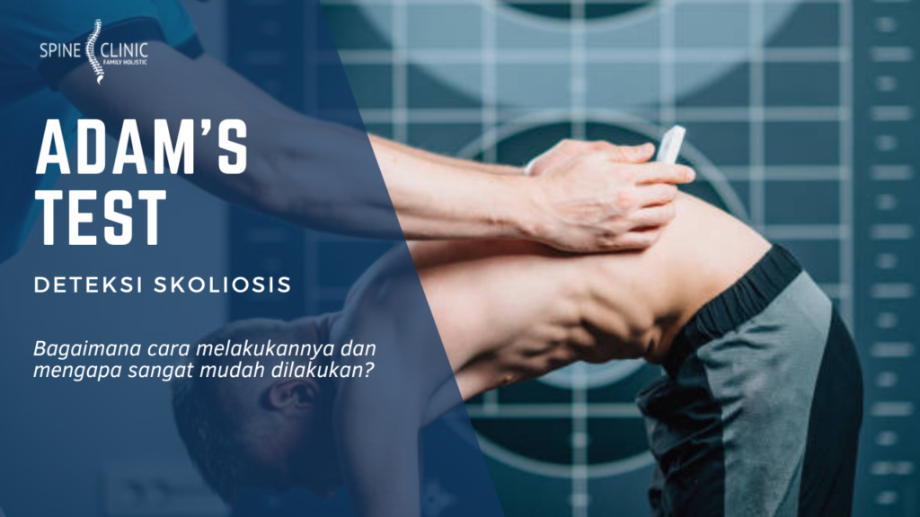 Kenali Adam's Forward Bend Test, Metode Deteksi Skoliosis Paling Mudah ...