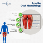 Cedera Hamstring: Cara Mengobati Dan 4 Faktor Risikonya!