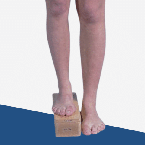 Kaki X - Gejala, Penyebab, dan Cara Penanganan yang Tepat
