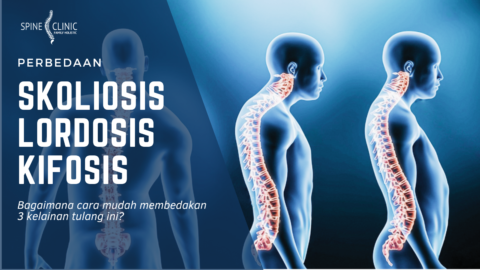 Perbedaan Skoliosis, Lordosis, dan Kifosis Lengkap & Solusinya