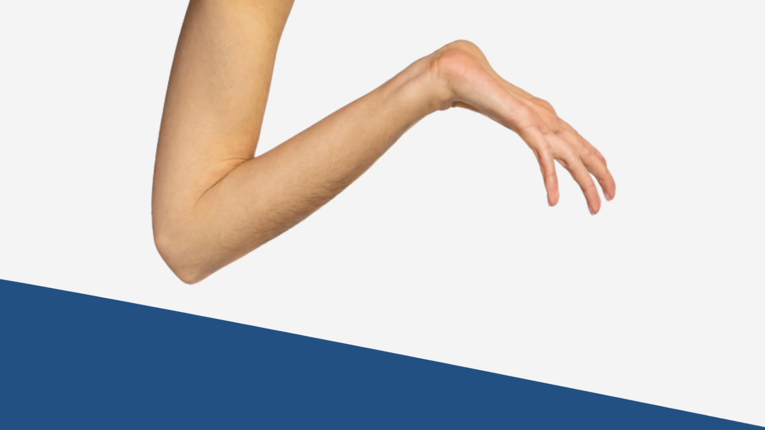 Marfan Syndrome - Tubuh Tinggi, Kurus, Dengan Lengan Panjang