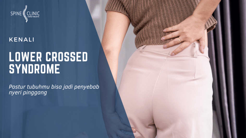 Lower Crossed Syndrome: Penyebab, Gejala, dan Penanganan